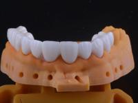China High Strength Zirconia Tooth Crown Ultra Translucent With Long Term Stable for sale
