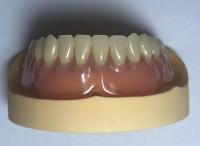 China Easy To Clean Full Acrylic Denture Highly Elastic for long term use for sale