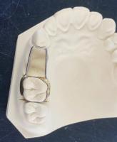 China High Accuracy Orthodontic Removable Appliance Safety Clear Hawley Retainer for sale