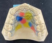 China High Accuracy Orthodontic Removable Appliance Safety Clear Hawley Retainer for sale