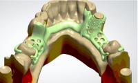 China Dental Lab Crown Dental CAD CAM Systems Customizable For Tooth Restorations for sale