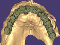 China Dental Lab Crown Dental CAD CAM Systems Customizable For Tooth Restorations for sale