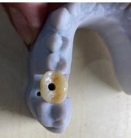 China High Precision Implant Supported Crown Stable And Easy Maintenance for sale
