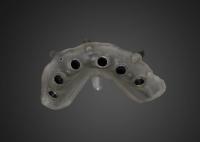 China Surgical sguide Plan for Implant Supported Crown Design and Alveolar Bone Information for sale