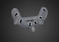 China Surgical sguide Plan for Implant Supported Crown Design and Alveolar Bone Information for sale
