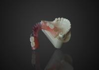 China Lightweight Comfortable Valplast Partial Denture Easy Cleaning High Transparency for sale