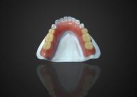 China Lightweight Comfortable Valplast Partial Denture Easy Cleaning High Transparency for sale