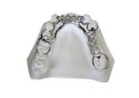 China Easy To Clean Metal Frame Partial Denture Comfortable For Long Lasting Use for sale