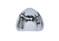 China Easy To Clean Metal Frame Partial Denture Comfortable For Long Lasting Use for sale
