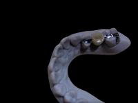 China Accurate White Long Lasting Maryland Bridge Dental Customizable For Restoration for sale