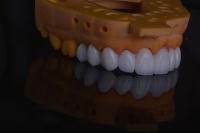 China High Strength Dental Lab Crowns Natural Looking For Tooth Restoration for sale