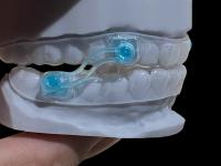 China Pressure Resistant Anti Snoring Device Easy To Use With Medical Grade for sale