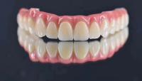 China Dental Lab Customized Implant Supported Metal Crown Natural Looking For Long Term Stability for sale