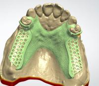 China Digital Metal Framework CAD CAM Dental Design Cocr Material With 3D Printing for sale