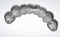 China Milled Egg Shell CAD CAM Dental Design For PMMA Temporary Bridge Implant for sale