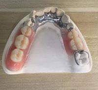 China Reliable Silver Metal Frame Denture Corrosion Resistance With Customizable Design for sale