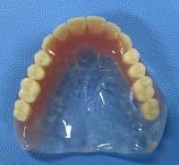 China Hypoallergenic Customized Removable Partial Denture With Pink Gum Color for sale