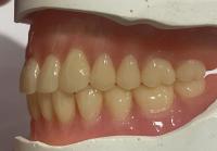 China Customizable Full Denture Acrylic Teeth High Stability For Dentistry Use for sale