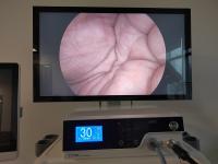 China TUYOU 4K 32'' Medical All In One Rigid  Endoscopy Camera System with LED Light Source For ENT Laparoscopy for sale