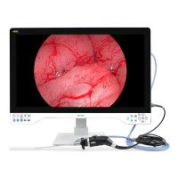 China Revolutionize Your Medical Practice with 4K 32 Inches Endoscope Camera System for Enhanced Imaging for sale