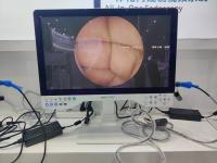 China Factory 15.6 Inches 4K Medical Endoscopy Camera System for Laparoscopy Urology for sale