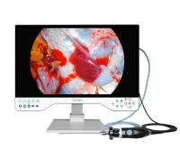 China Factory 15.6 Inches 4K Medical Endoscopy Camera System for Laparoscopy Urology for sale