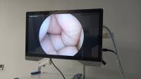 China TUYOU 27inches 1080P Full HD All In One Medical Endoscope Camera  for Arthroscope for sale
