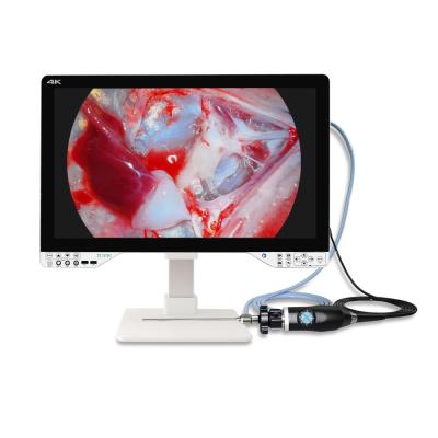 China TUYOU Medical 4K All In One Endoscopy Camera System With Light Source And Monitor For Laparoscopic Surgery for sale