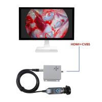China International Standard C-mount Portable Endoscope Camera with HDMI/CVBS Output Signal for sale