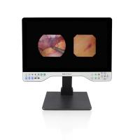 China 1080P Full HD Endoscope System Rigid and Flexible 24 Inches All in One Video Recorder Camera for sale