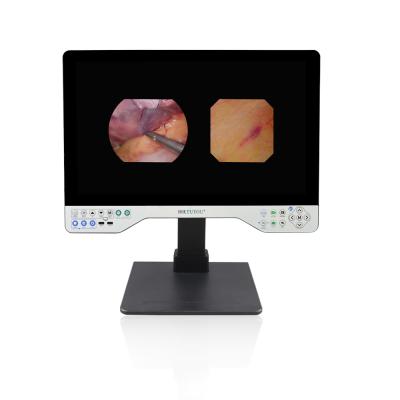 China 1080P Full HD Endoscope System Rigid and Flexible 24 Inches All in One Video Recorder Camera for sale