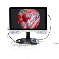 China 1080P Full HD Endoscope System Rigid and Flexible 24 Inches All in One Video Recorder Camera for sale