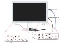China TUYOU All-in-one Endoscope Camera System of 27inch FHD/4K for Nasal Ear and Laparoscopic Surgery for sale