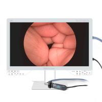 China All-in-one 27''FHD/4K Endoscope Camera System for ENT, Urology, and Arthroscopy endoscopy -Factory Direct for sale