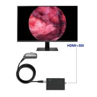 China TUYOU Portable Medical Endoscope Camera For Otoscopy, Nasal, And Urological Surgery Use for sale