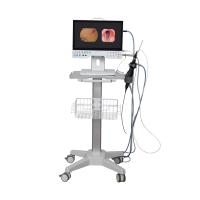 China All in One Rigid and Flexible Endoscopy Camera TU-15LSD1E HDMI/SDI/CVBS/VGA/DVI Output Interface and Built-in Light Source for sale