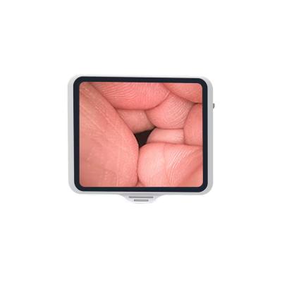 China TUYOU Flexible Endoscope With 3.5 Inch Screen, Reusable For Fiber Optic Bronchoscopy And Pet Health for sale