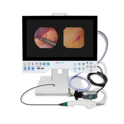 China Good Quality 1080P 15.6 Inch Medical Endoscopy Equipment Rigid & Flexible Laryngoscope Imaging System for sale