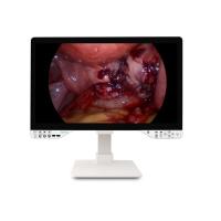 China 27 Inch FHD 1080P Endoscopic Camera System Only Rigid Endoscope with Monitor and 100W Effective Optical Power for sale