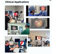 China 24 quot Monitor Medical Endoscope Camera for Surgical Laparoscope Endoscopy Urology Arthroscope for sale