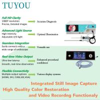 China Advanced 4-in-1 Endoscopic System Featuring Simultaneous Rigid and Flexible Imaging for sale