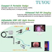 China Versatile 2-Output Portable Endoscope for Real-Time Diagnostics for sale