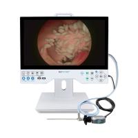 China 15 Inch FHD Flexible And Rigid Endoscope Camera System With Record Compatible For Surgery Using for sale