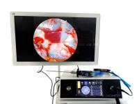 China TUYOU Manufacturers Full HD Camera Medical Rigid Endoscope For Ent Hospital And Urology Surgery for sale