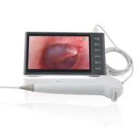 China HD Disposable Endoscope Camera Flexible Scope Imaging Solution for Professionals for sale