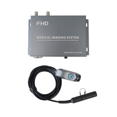 China Portable 4-Output 1080p Endoscopic Camera System – Direct from Manufacturer for ENT & Gynecology Endoscopy for sale