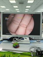 China TUYOU Medical 4K All In One Endoscopy Camera System With Light Source And Monitor For Laparoscopic Surgery for sale