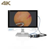 China TUYOU All-in-One FHD Endoscopy Camera System with 24