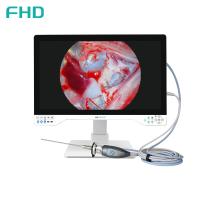 China TUYOU All-in-One FHD Endoscopy Camera System with 32 Inches Surgical Monitor for ENT and Urology Procedures for sale
