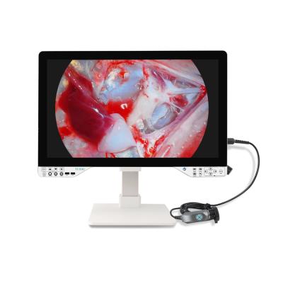 China 27inch FHD Endoscope Camera System with 100W LED Light for ENT Surgery for sale